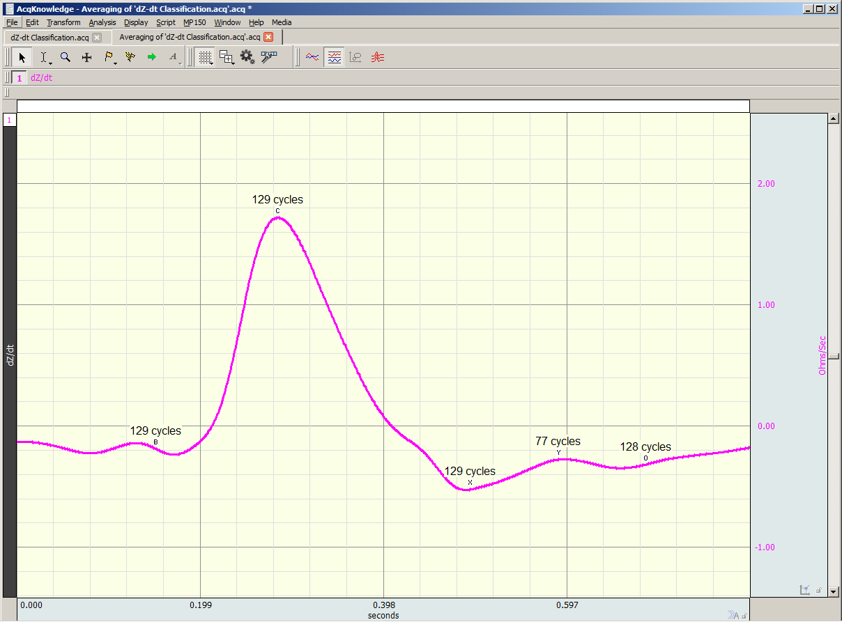 Impedance Cardiography - BIOPAC Blog